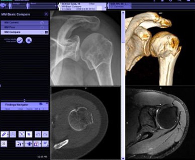 CT - Zwanger-Pesiri Radiology