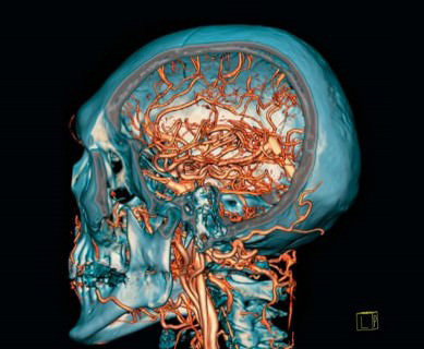 CT - Zwanger-Pesiri Radiology