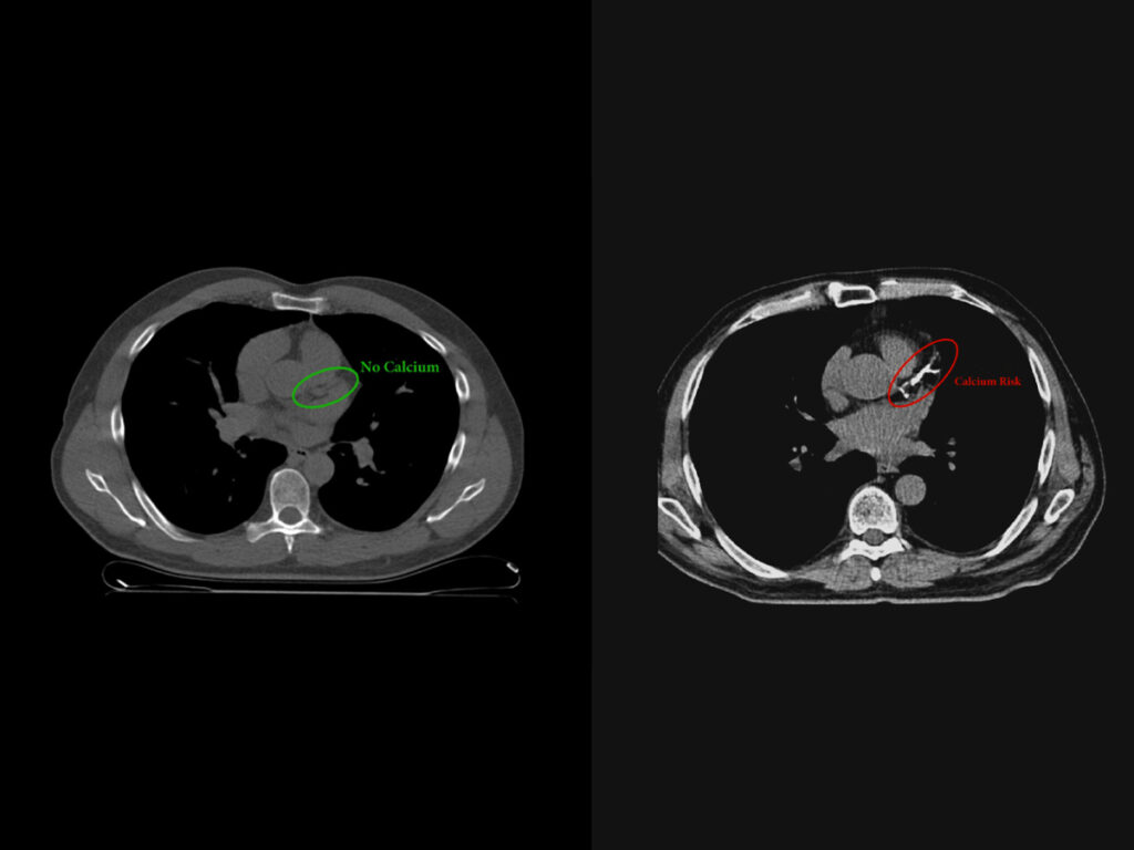 Brentwood - Zwanger-Pesiri Radiology