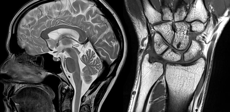 MRI - Zwanger-Pesiri Radiology