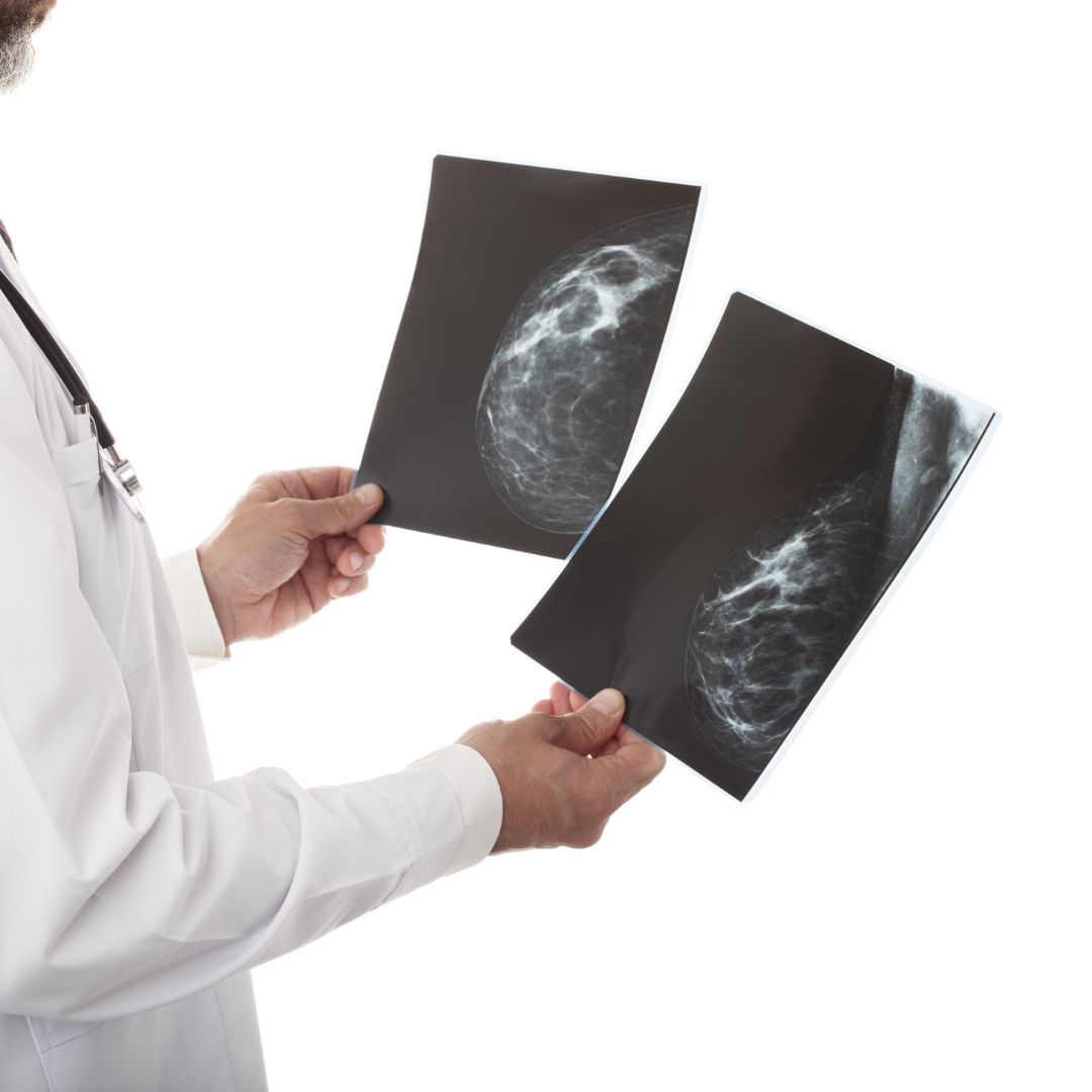 Important Women Imaging Services Offered at ZP Rad - Zwanger-Pesiri ...