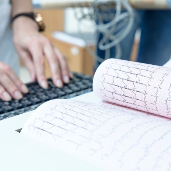 What Is a Cardiac Stress Test? - Zwanger-Pesiri Radiology