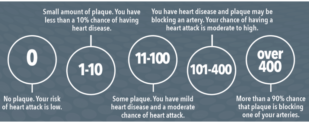 Calcium Scoring - Zwanger-Pesiri Radiology