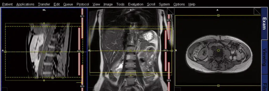 Body MRI - Zwanger-Pesiri Radiology