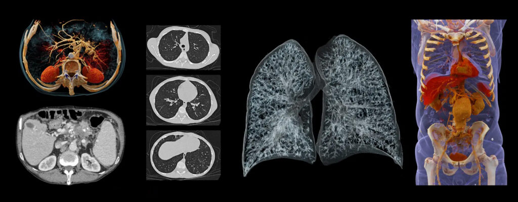 Body CT - Zwanger-Pesiri Radiology
