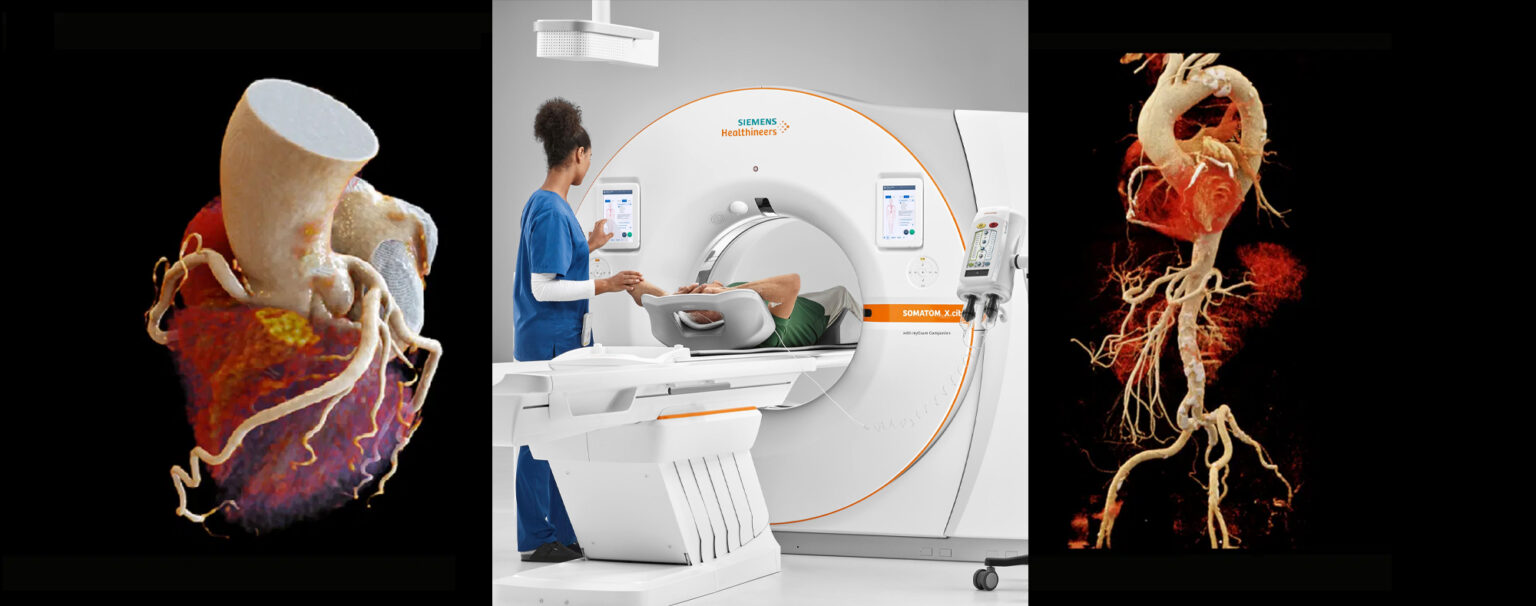 Coronary CT Angiography - Zwanger-Pesiri Radiology