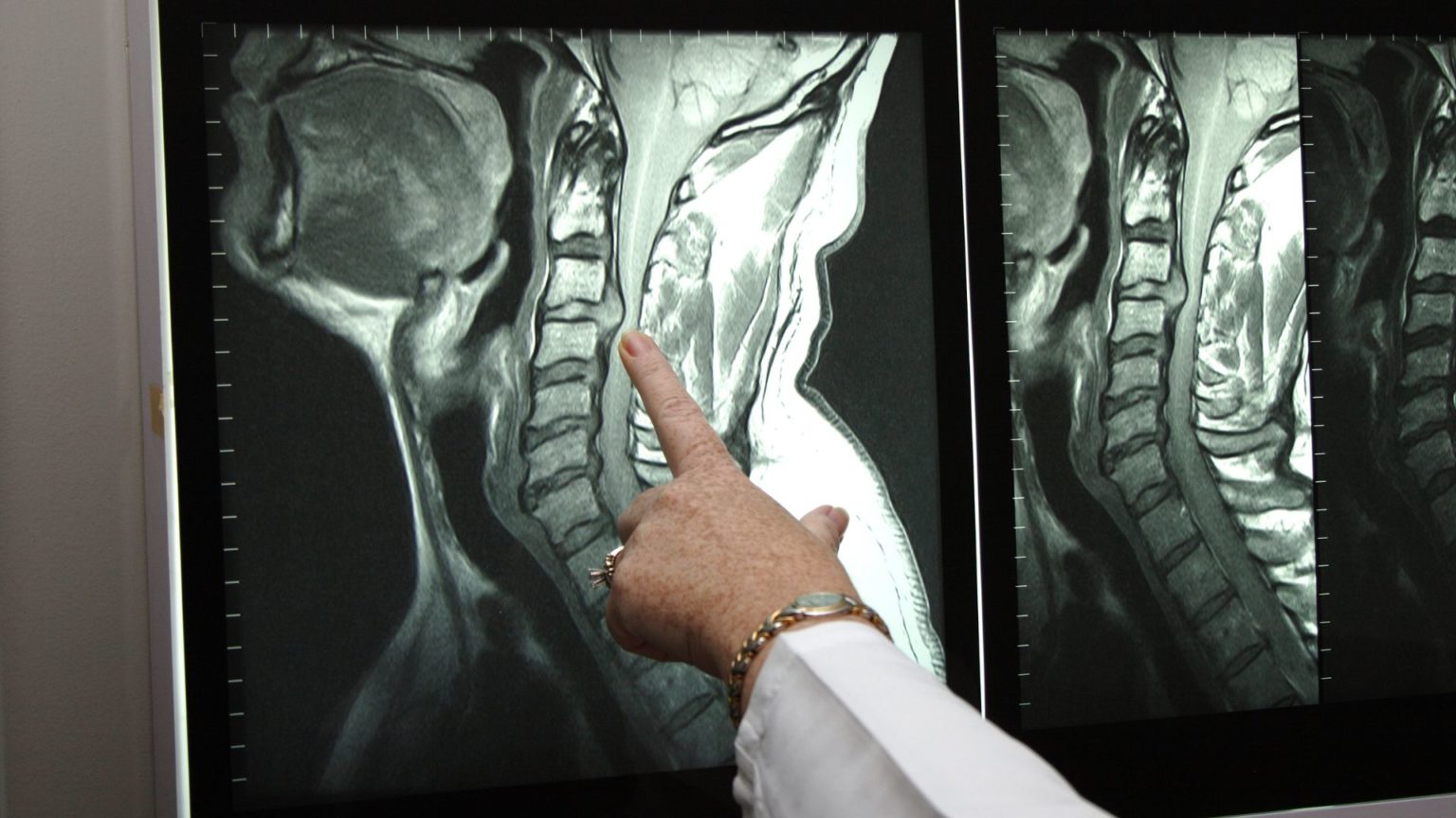 ZP RAD, Author at Zwanger-Pesiri Radiology