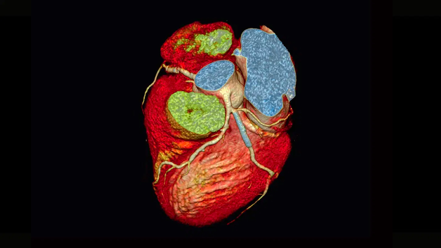 Excellence in Cardiac Imaging - Zwanger-Pesiri Radiology