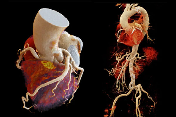 Carle Place - Zwanger-Pesiri Radiology