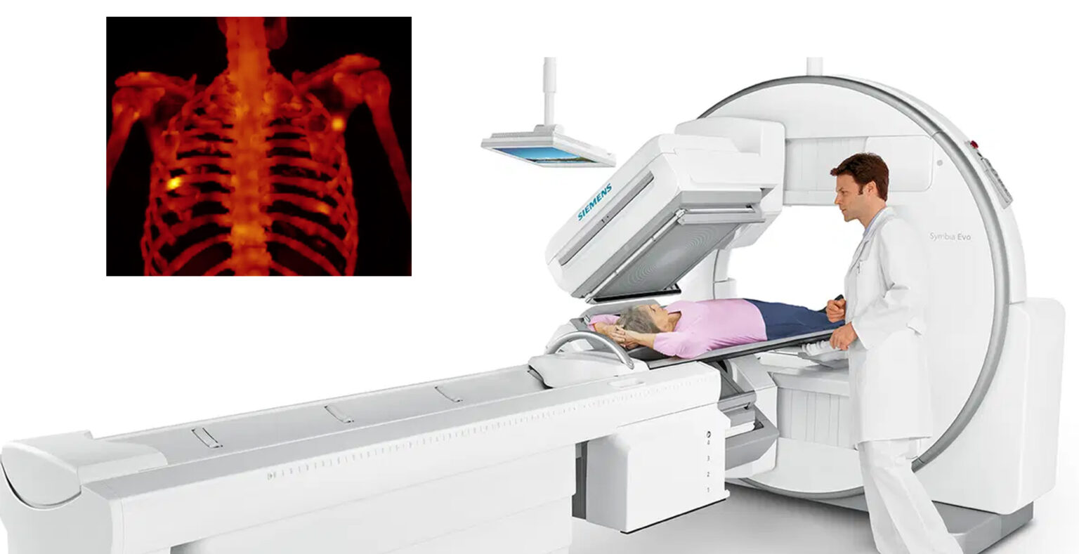 Bone Scan at ZP - Zwanger-Pesiri Radiology